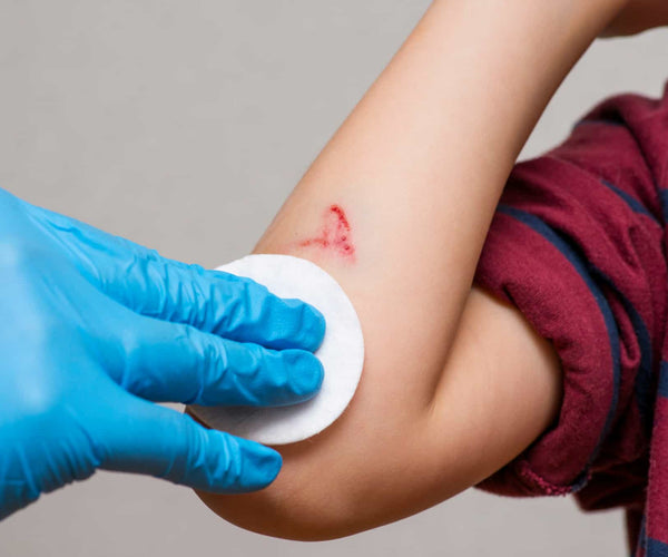 First Aid for Cuts, Bleeding and Minor Wounds – First Aid Kits UK